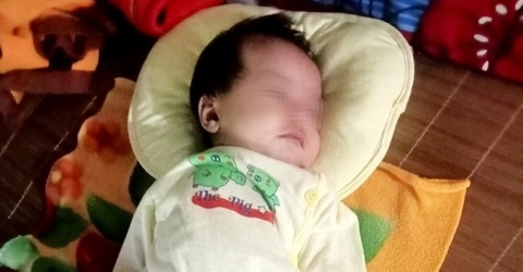 Con bị khoèo chân bẩm sinh, bố mẹ cạn kiệt tiền cứu chữa